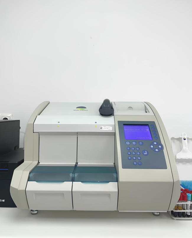 Analyse TSH : dépistage et suivi des troubles thyroïdiens